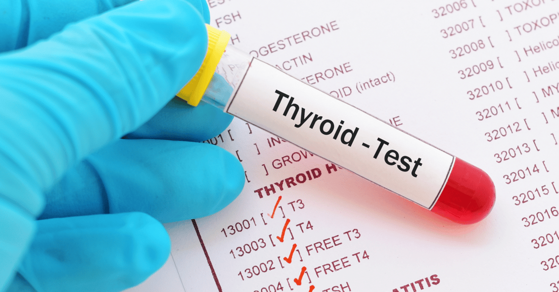 Thyroid pathology analysis with Immunoassays